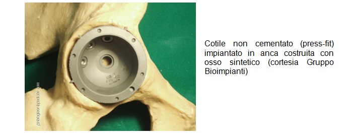 Cotile | Patologieortopediche.com - dott. Fabrizio Rivera - Torino